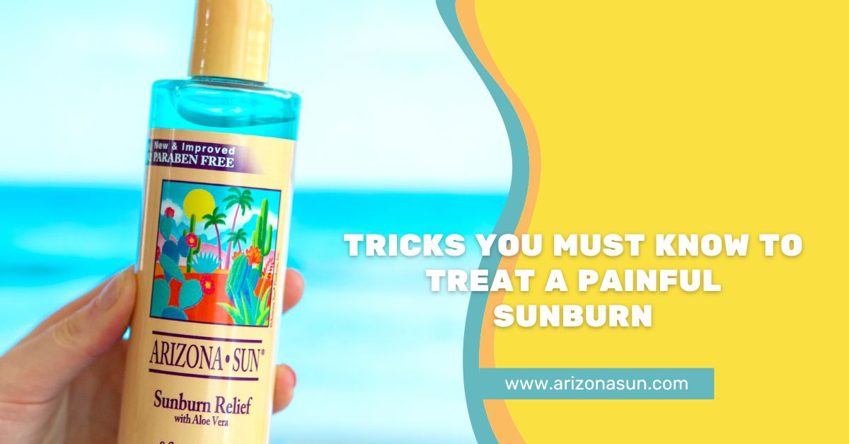 Tricks You Must Know to Treat a Painful Sunburn - Arizona Sun